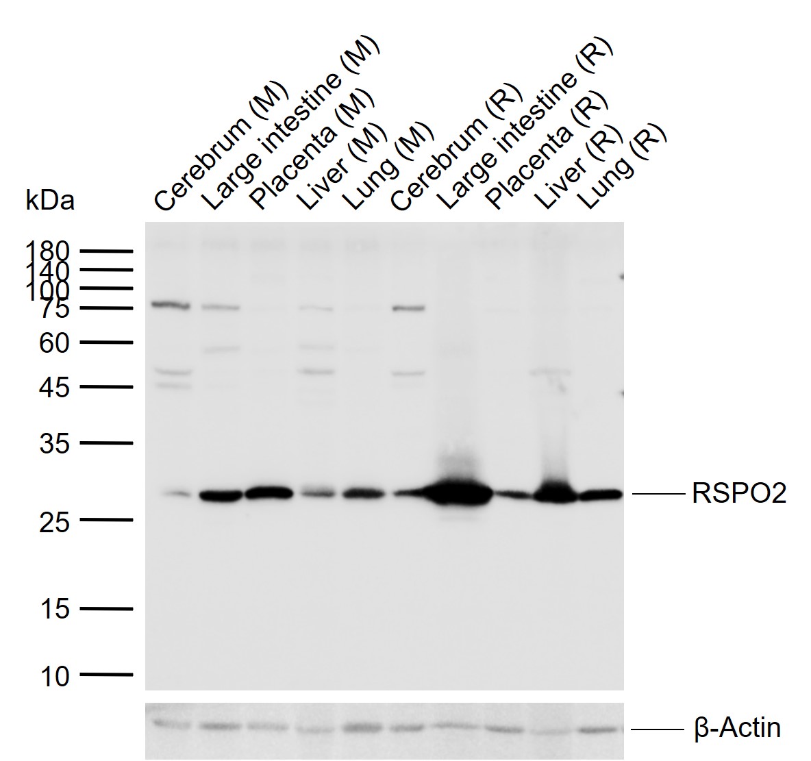 RSPO2 Rabbit pAb(bs-18876R)-50ul/100ul/200ul价格_品牌:Bioss-丁香通