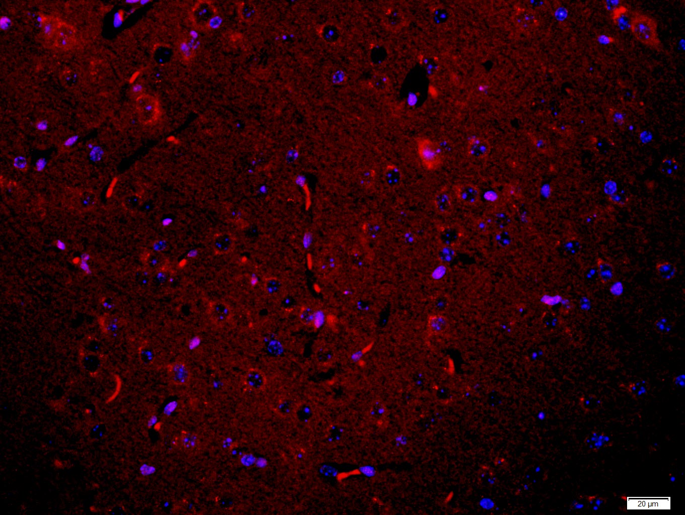 Neuronatin Rabbit pAb(bs-11519R)-50ul/100ul/200ul价格_品牌:Bioss-丁香通