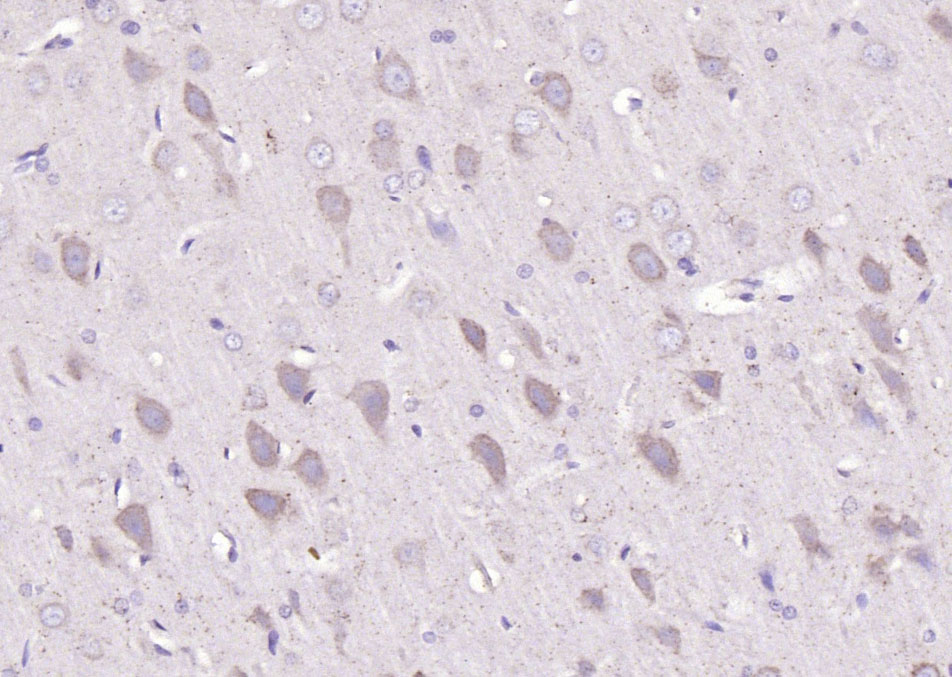 BMAL1 Rabbit pAb(bs-3750R)-50ul/100ul/200ul价格_品牌:Bioss-丁香通