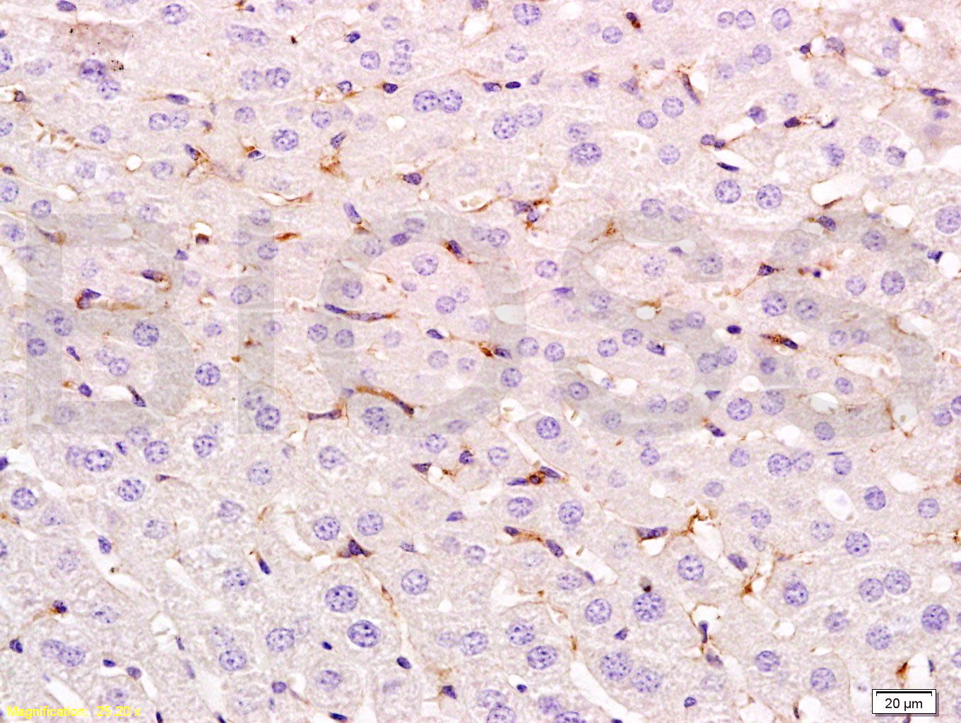 eNOS Rabbit pAb(bs-0163R)-50ul/100ul/200ul价格_品牌:Bioss-丁香通