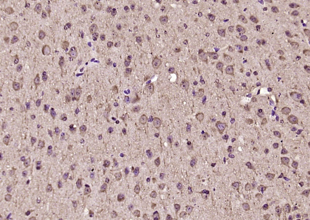 phospho-IKK alpha/beta (Ser176 + Ser180) Rabbit pAb(bs-3237R)-50ul/100ul/200ul价格_品牌:Bioss-丁香通