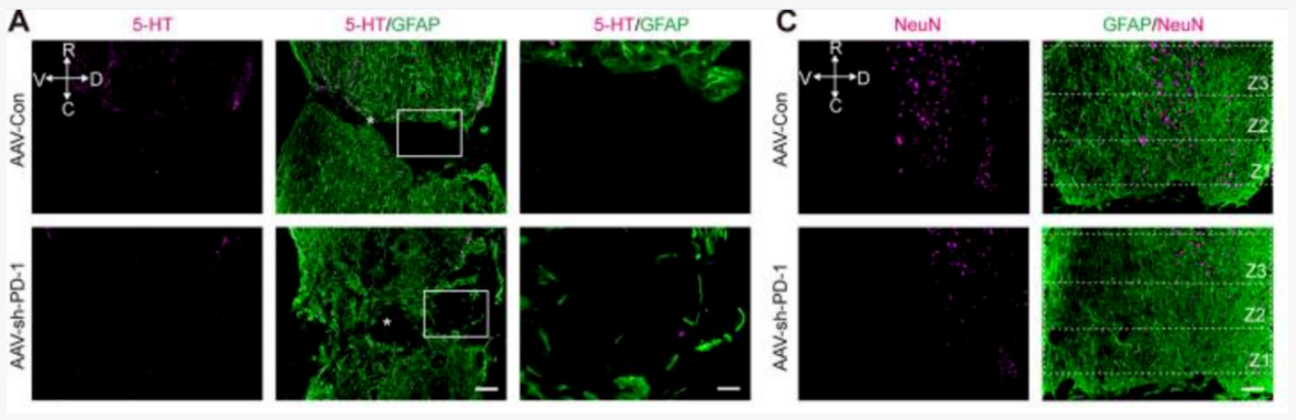 AAV靶向神经研究指南【注射方式与文献应用】-公司新闻-吉满生物科技(上海)有限公司