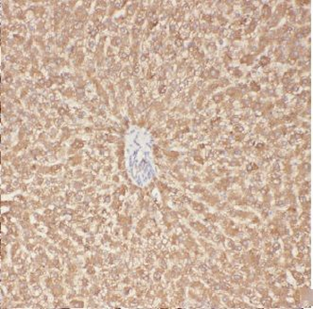 ACSS3 Antibody抗体，orb624470，biorbyt价格_品牌:biorbyt-丁香通