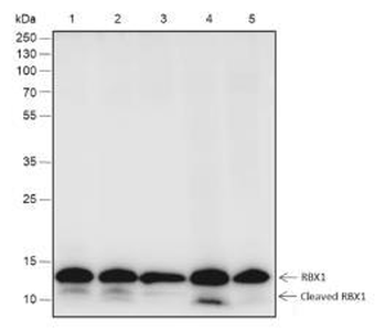 RBX1 Recombinant Rabbit Monoclonal Antibody抗体，orb1499278，biorbyt价格_品牌 ...