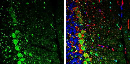 C17orf75 antibody [N1C1]抗体，orb556565，biorbyt价格_品牌:biorbyt-丁香通