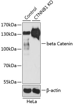 beta Catenin Antibody, KO Validated抗体，orb1274536，biorbyt价格_品牌:biorbyt-丁香通