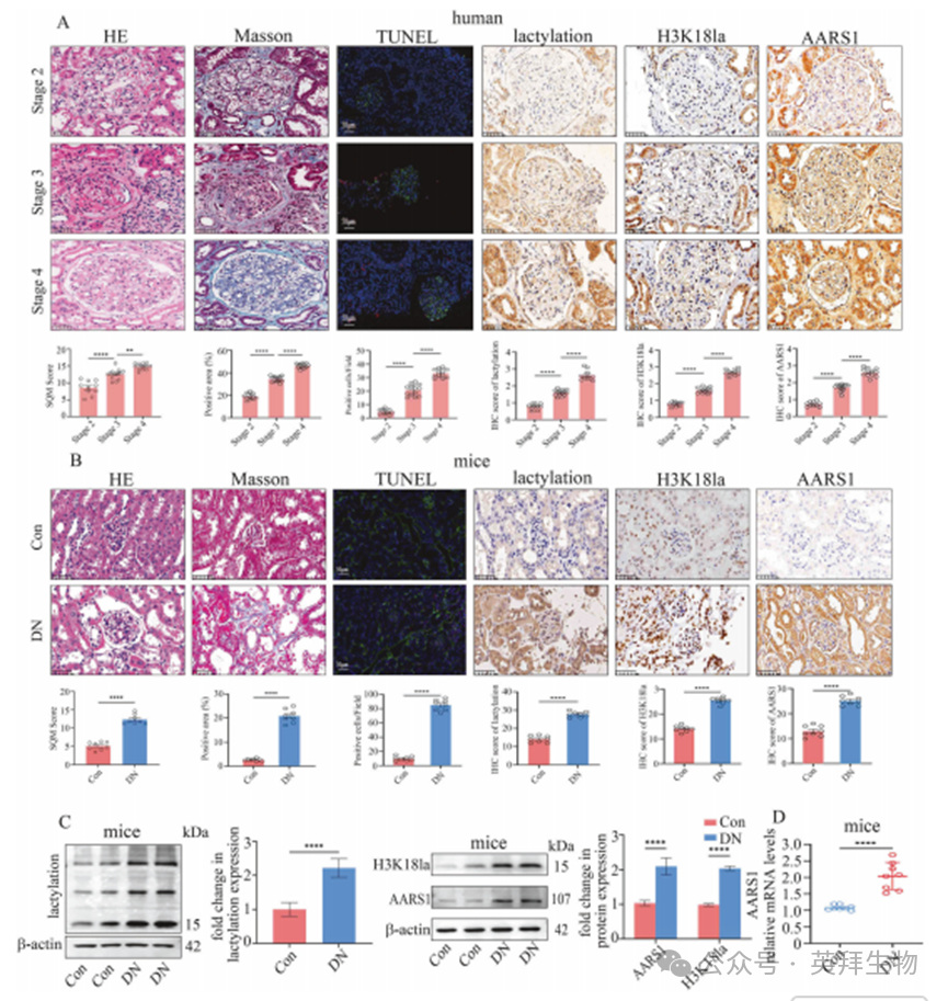 AARS1介导的H3K18与STAT1乳酸化修饰促进糖尿病肾病中铁死亡的发生 - 企业动态 - 丁香通