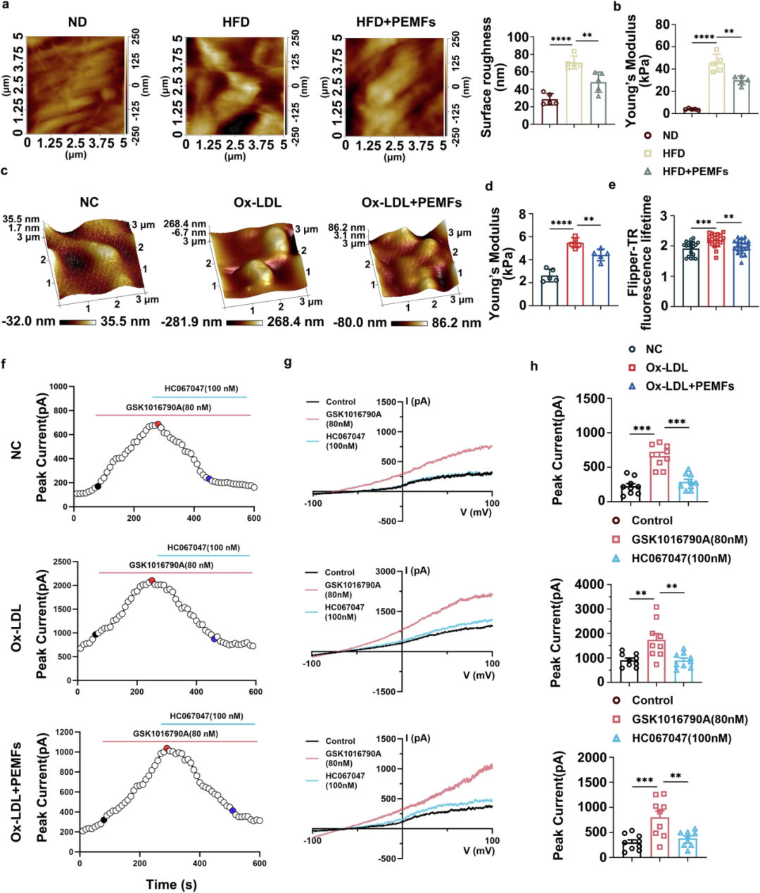 STTT | 四川大学华西医院魏全/付琛颖揭示脉冲电磁场通过调节膜张力从而抑制细胞焦亡和动脉粥样硬化斑块形成的机制 - 企业动态 - 丁香通