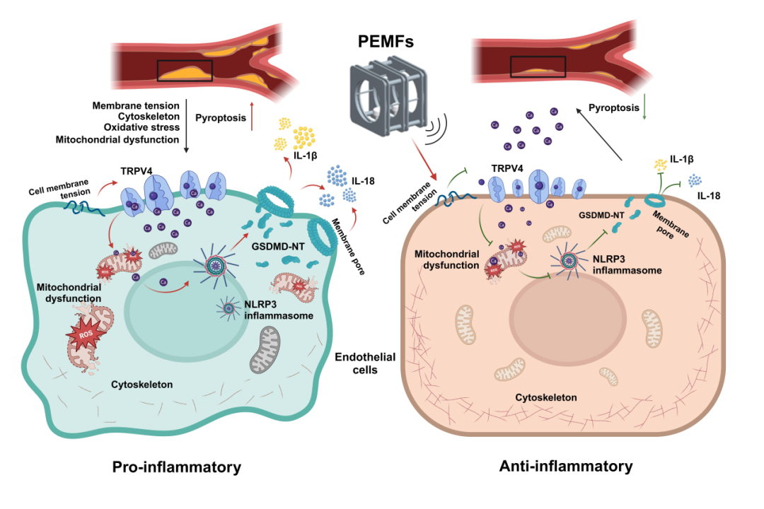 STTT | 四川大学华西医院魏全/付琛颖揭示脉冲电磁场通过调节膜张力从而抑制细胞焦亡和动脉粥样硬化斑块形成的机制-公司新闻-和元生物技术 ...