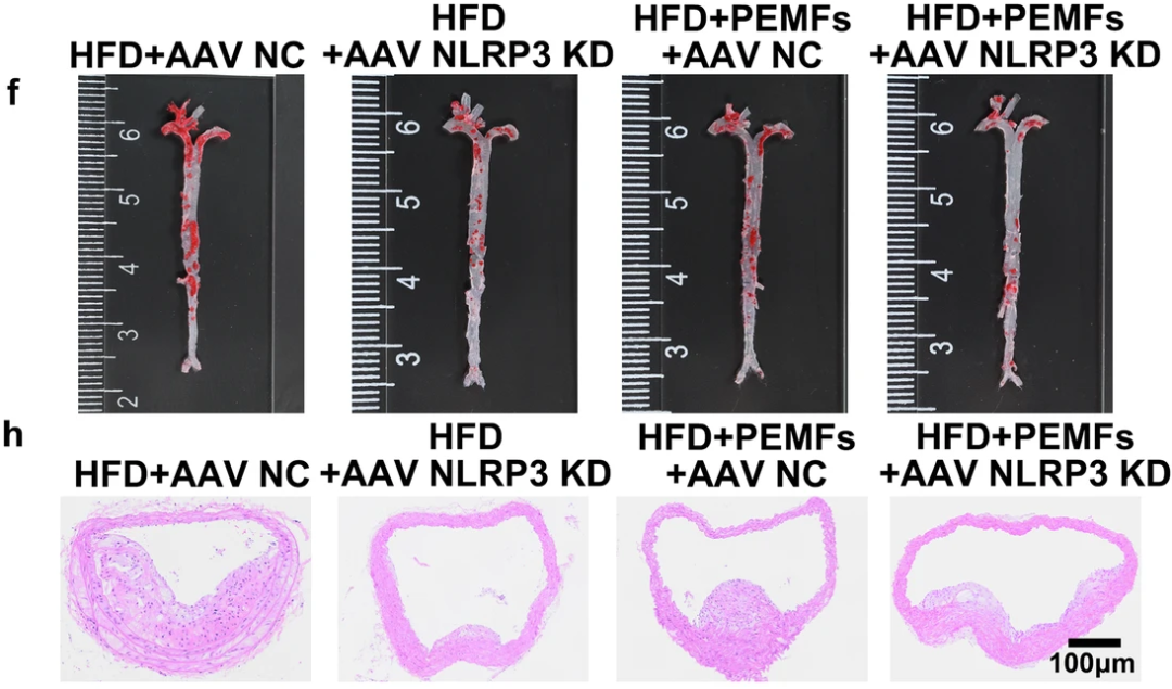 STTT | 四川大学华西医院魏全/付琛颖揭示脉冲电磁场通过调节膜张力从而抑制细胞焦亡和动脉粥样硬化斑块形成的机制-公司新闻-和元生物技术 ...