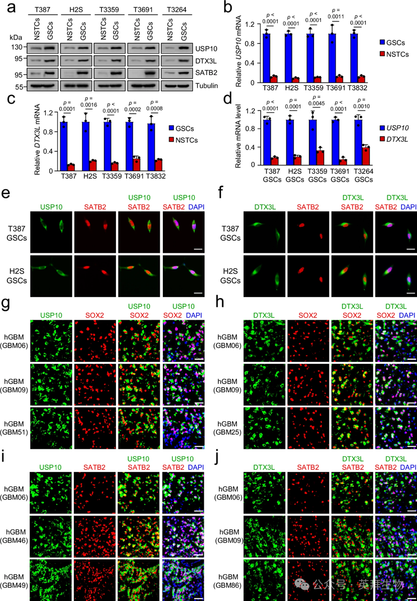胶质母细胞瘤耐药与复发关键机制曝光：USP10拮抗DTX3L，稳定SATB2 - 企业动态 - 丁香通