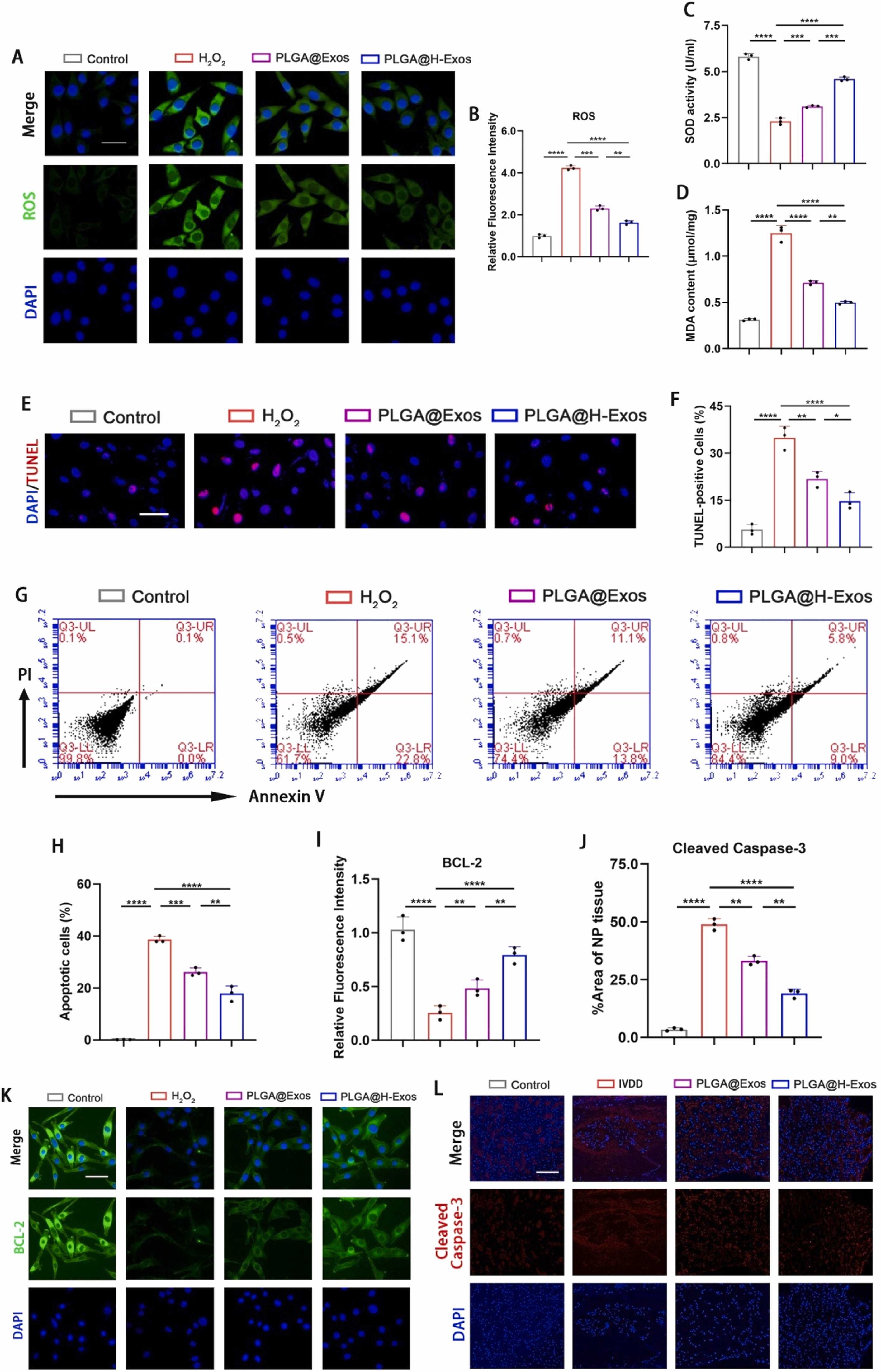 椎间盘退变“终结者”来了？PLGA@H-Exos激活PPAR-γ通路，从机制到动物实验一网打尽！-公司新闻-研载生物科技（上海）有限公司