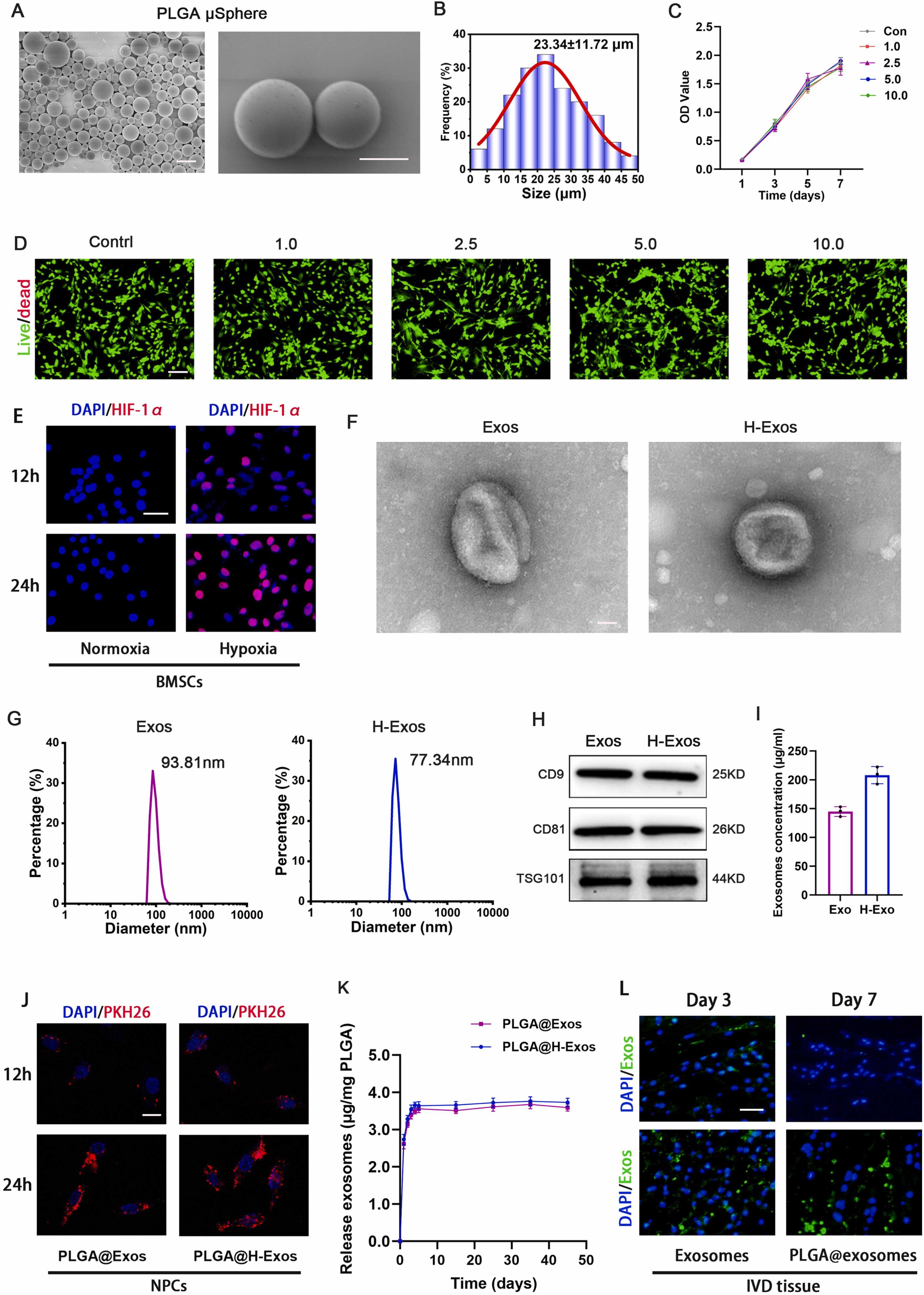 椎间盘退变“终结者”来了？PLGA@H-Exos激活PPAR-γ通路，从机制到动物实验一网打尽！-公司新闻-研载生物科技（上海）有限公司