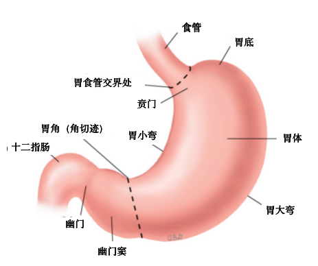 应激性溃疡