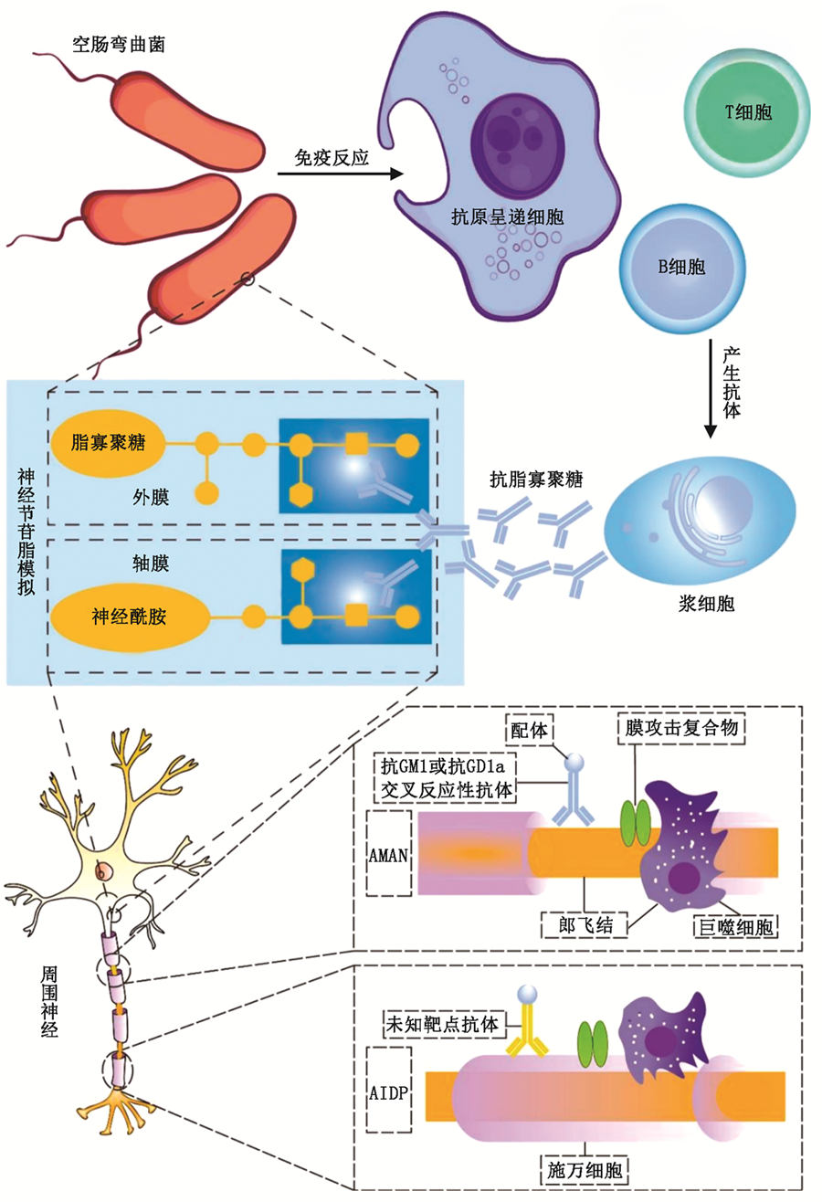 吉兰-巴雷综合征