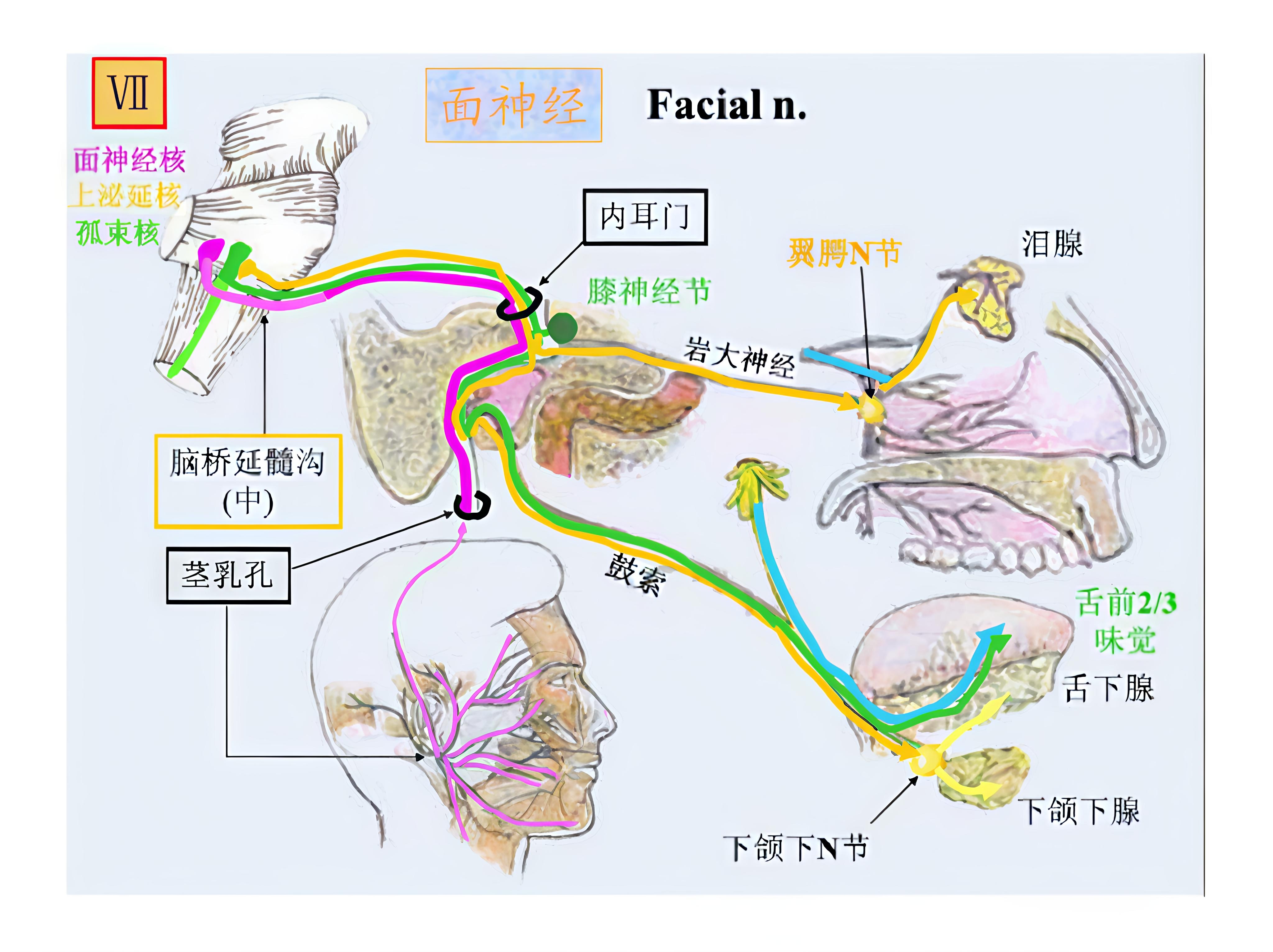 周围性面神经麻痹